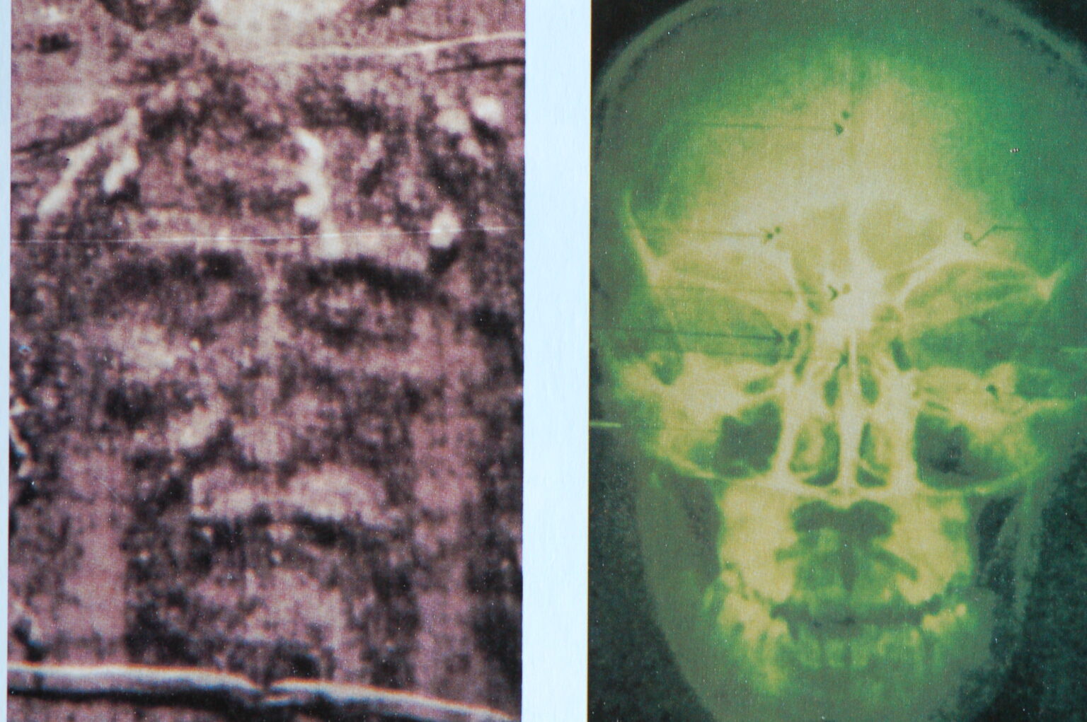 Image Qualities of the Shroud of Turin – Shroud3d